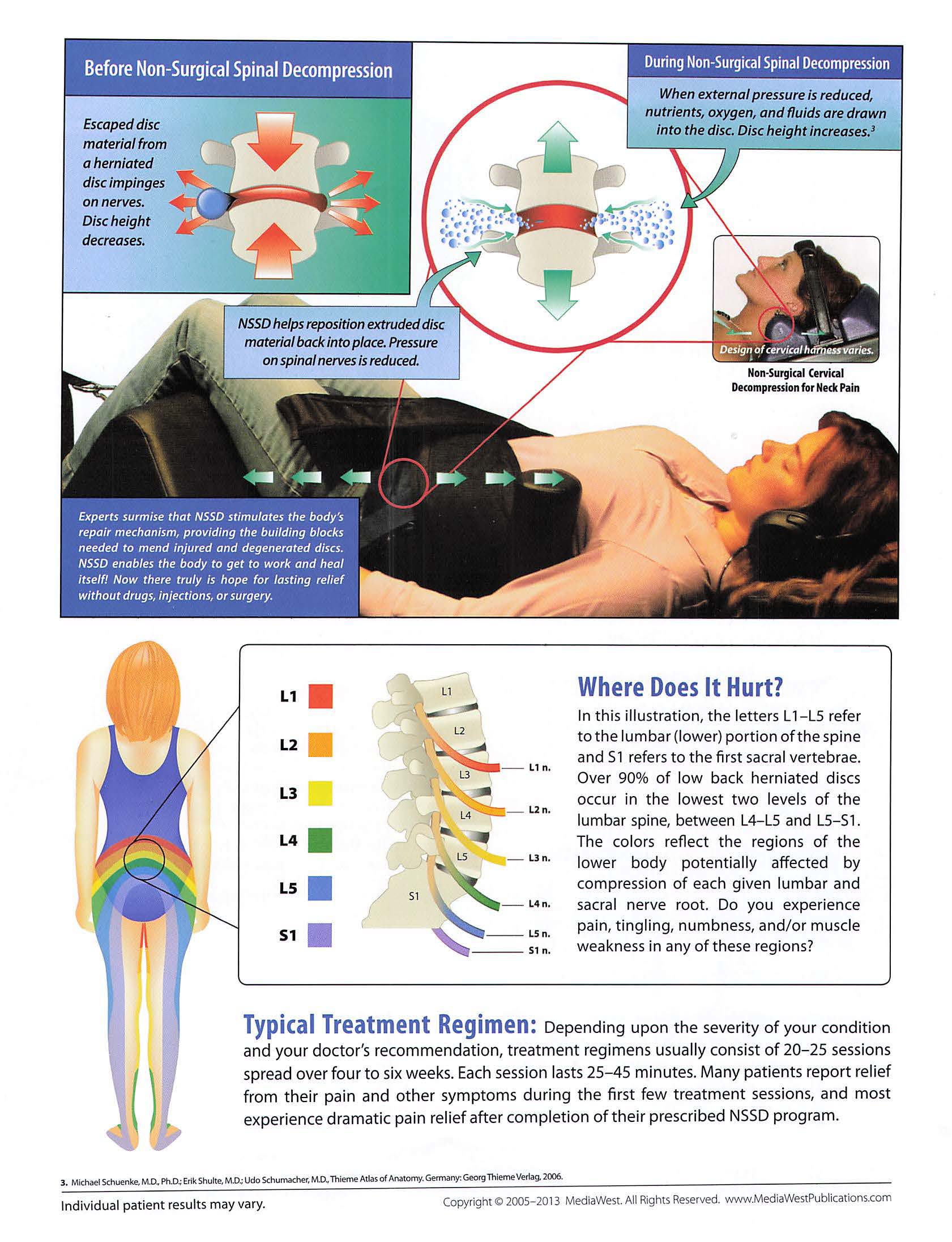 Non-Surgical Spinal Decompression Treatment
